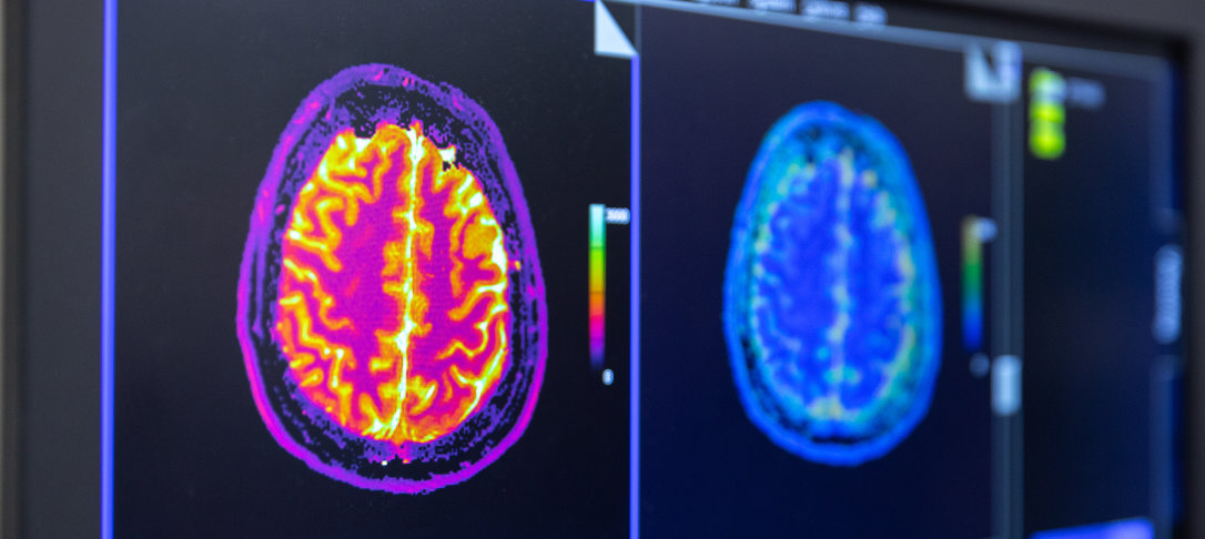 Magnetic Resonance (MR) fingerprinting | Events | Imperial College London