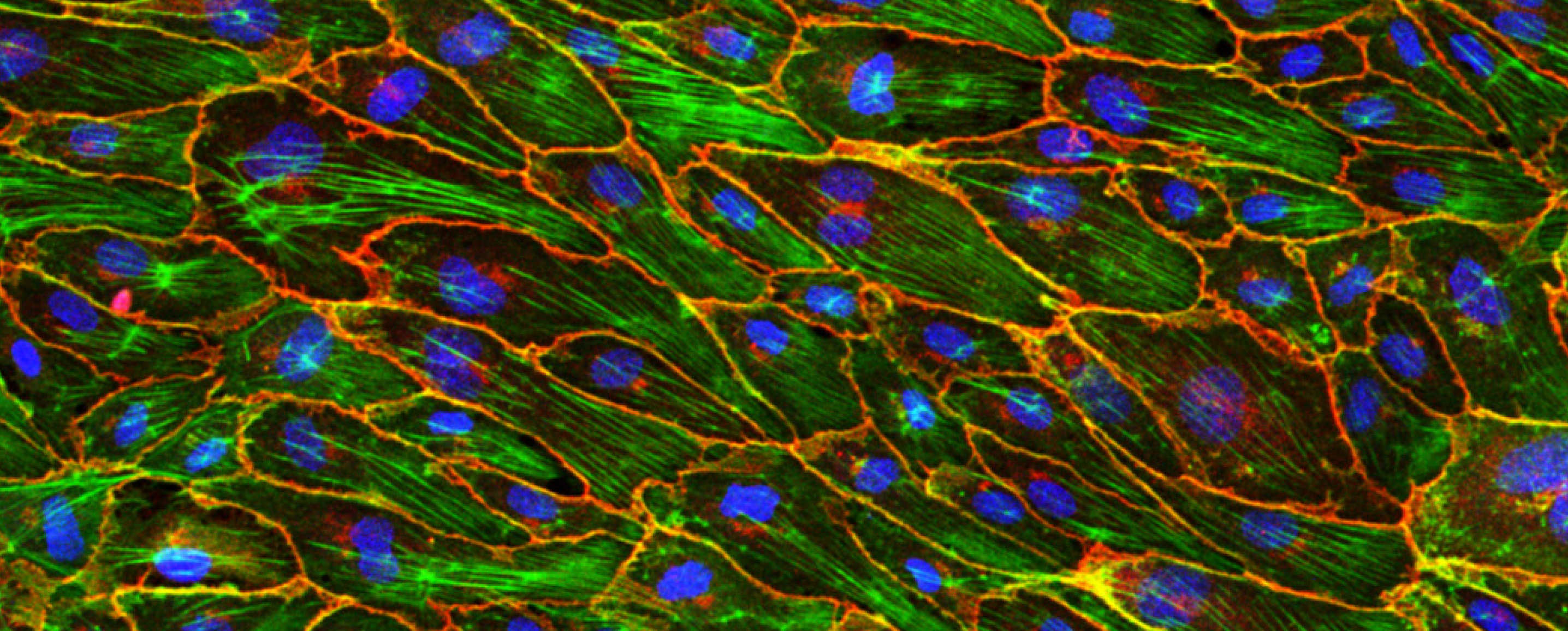 Biomechanics and mechanobiology | Faculty of Engineering | Imperial ...