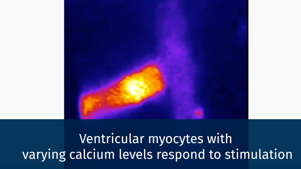 Cardiac Function | Faculty of Medicine | Imperial College London