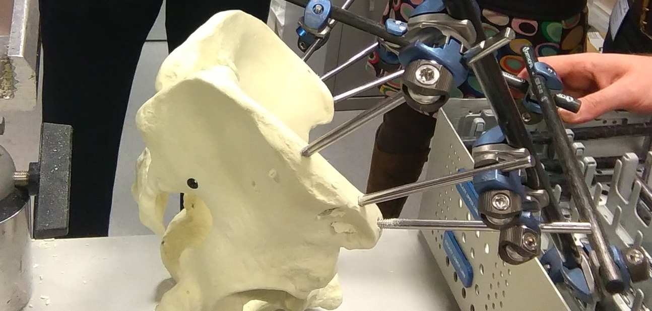 Essentials of External Fixation | Faculty of Medicine | Imperial ...