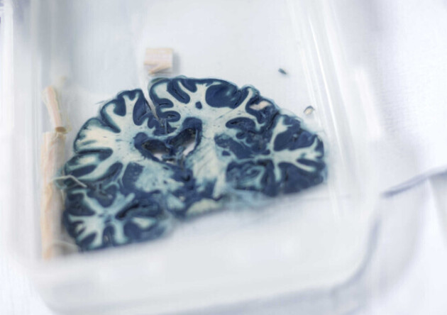 Five breakthroughs in Brain Sciences at Imperial | Imperial News ...