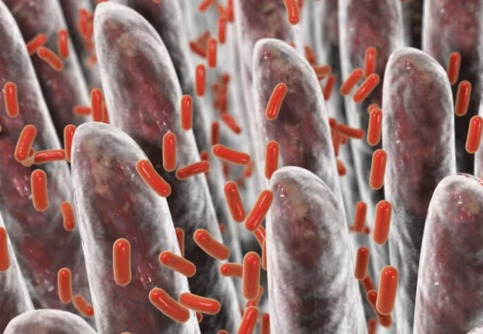 Understanding immunotherapy-induced colitis to improve cancer patient ...