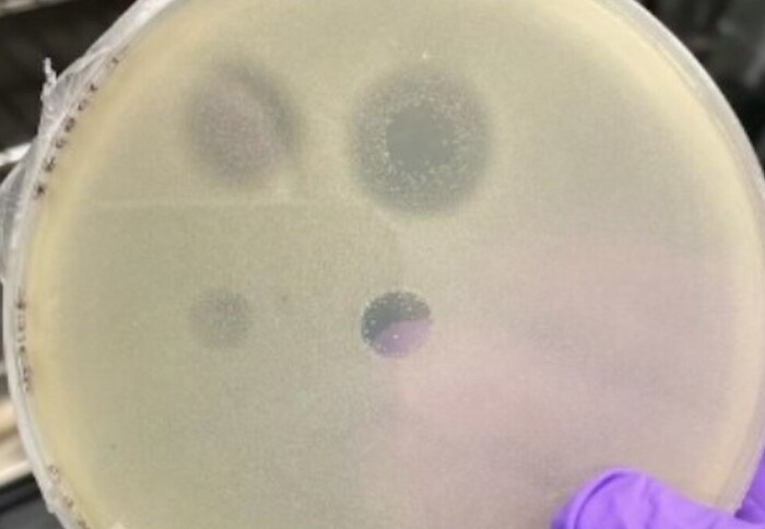 Archaea can kill bacteria with new antibacterials | Imperial News ...