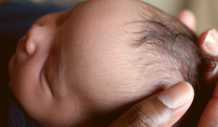 Challenges in Neonatal Encephalopathy (Online) | Events | Imperial ...