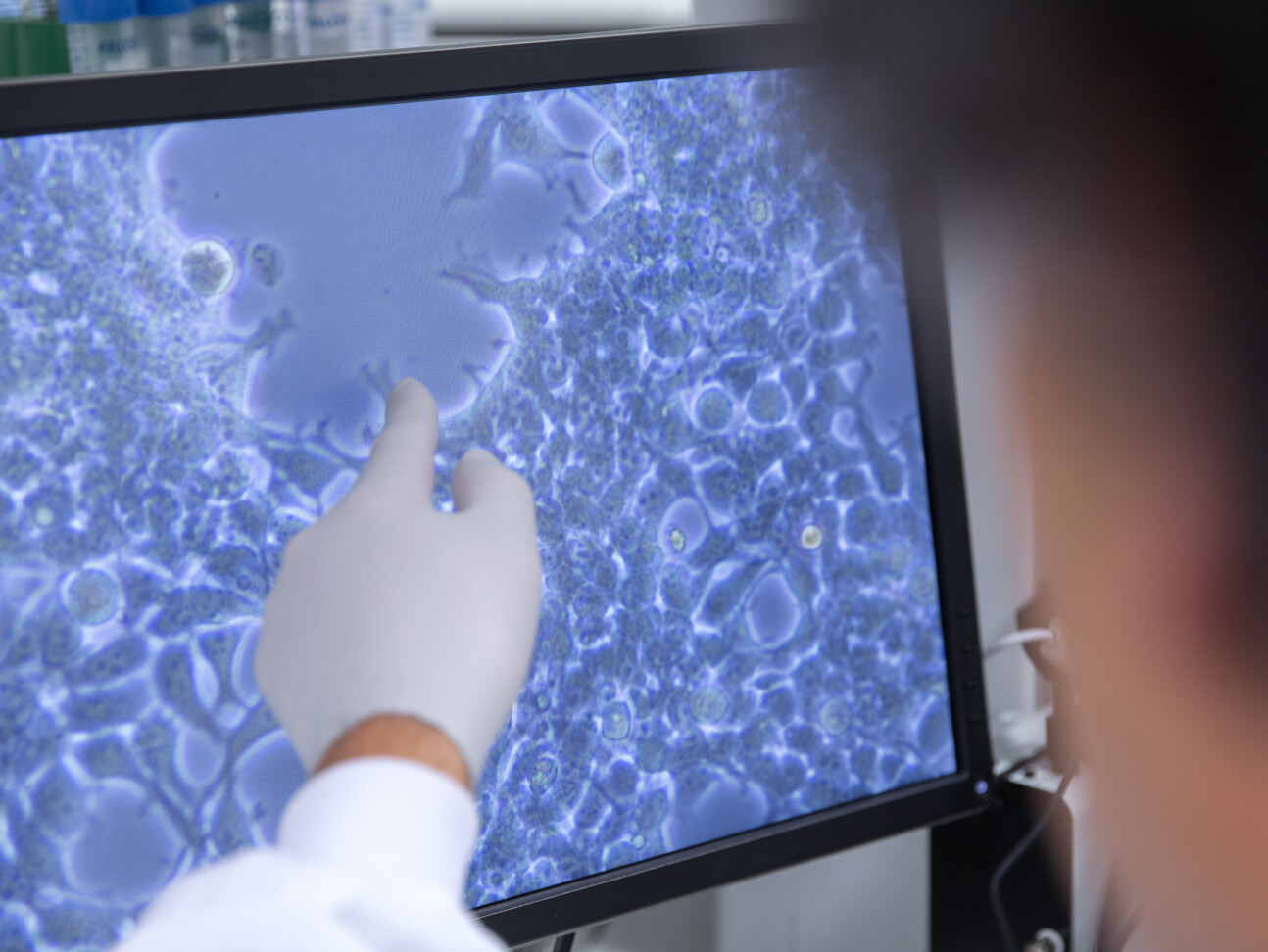 Brain fluid surgery to a world-first lunar-Earth flyby: News from ...