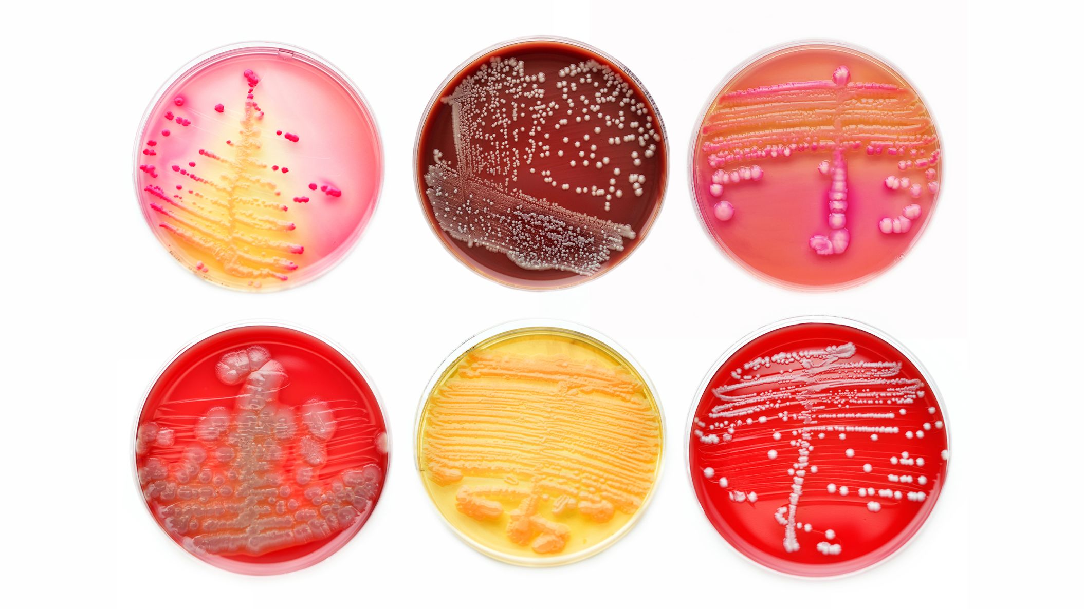 Antimicrobial resistance, a silent pandemic